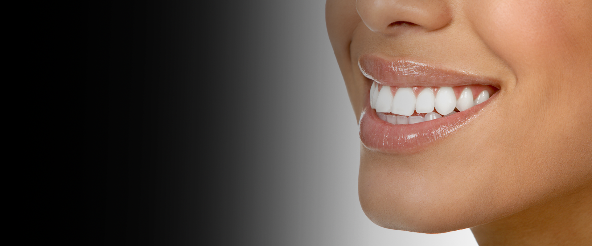 Ysis Dental - Cabinet dentaire à Schaerbeek